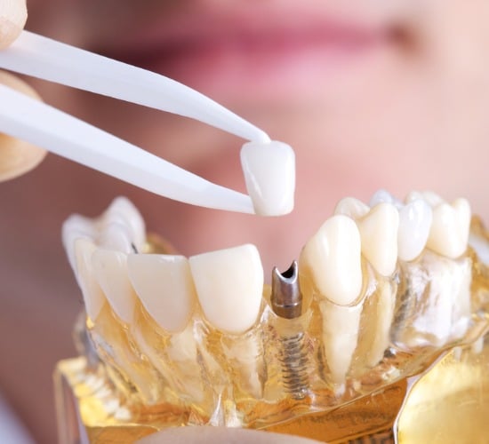 Gallery 57 Dental- General & Cosmetic Dentistry Serving New York, NY